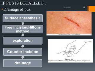 abscess.pptx | Free Download