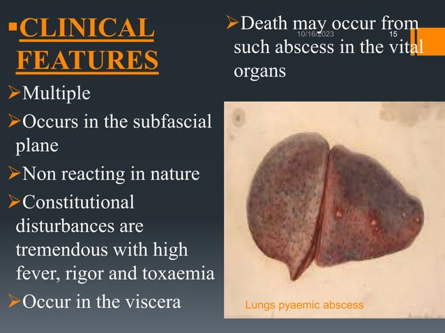 abscess.pptx