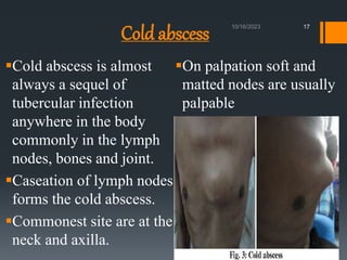 abscess.pptx | Free Download
