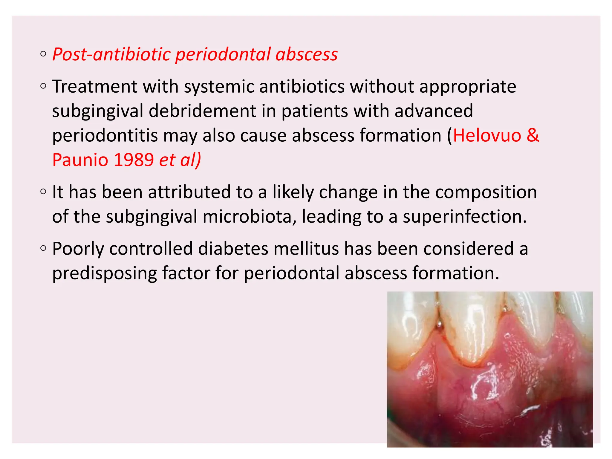 presentation abscess of the periodontium .pptx