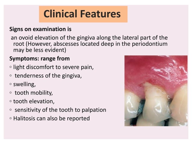 presentation abscess of the periodontium .pptx