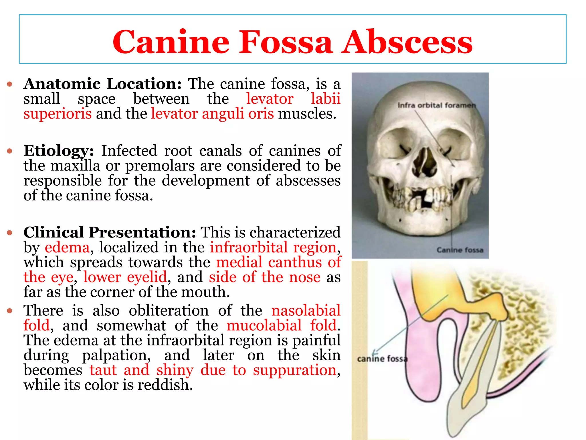 Abscess oral maxillo-presentation | PPTX