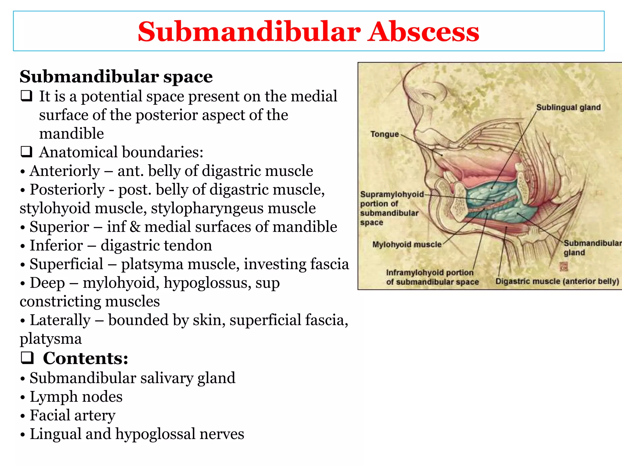 Abscess oral maxillo-presentation | PPTX