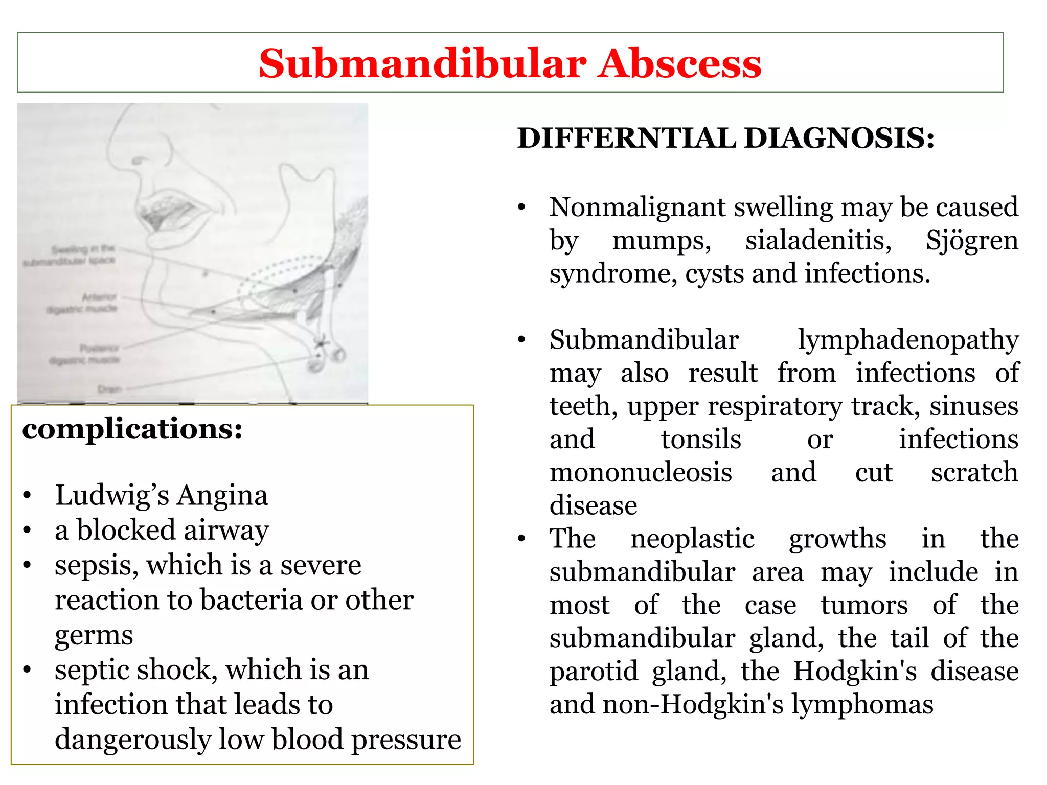 Abscess oral maxillo-presentation | PPTX