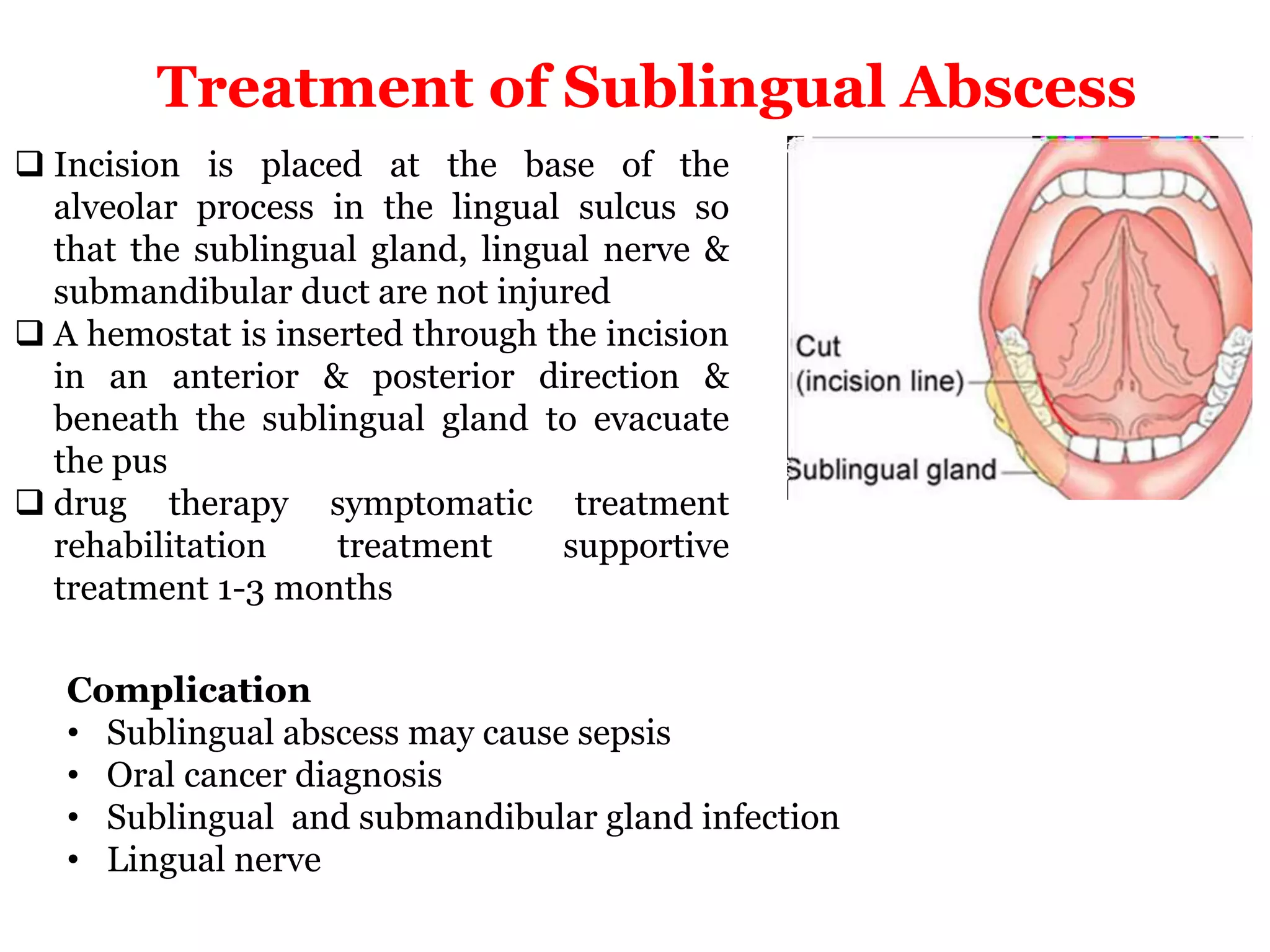 Abscess oral maxillo-presentation | PPTX