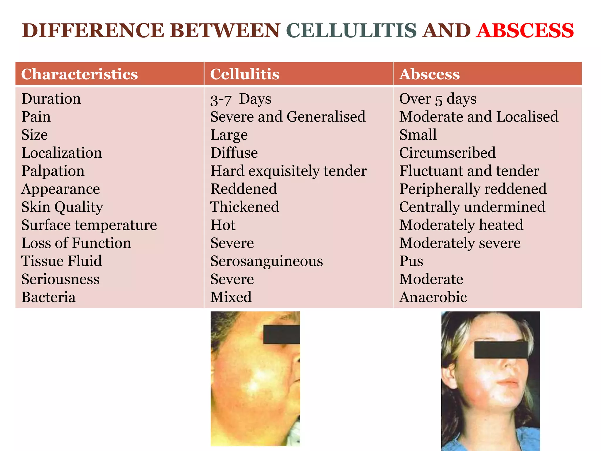 Abscess oral maxillo-presentation | PPTX