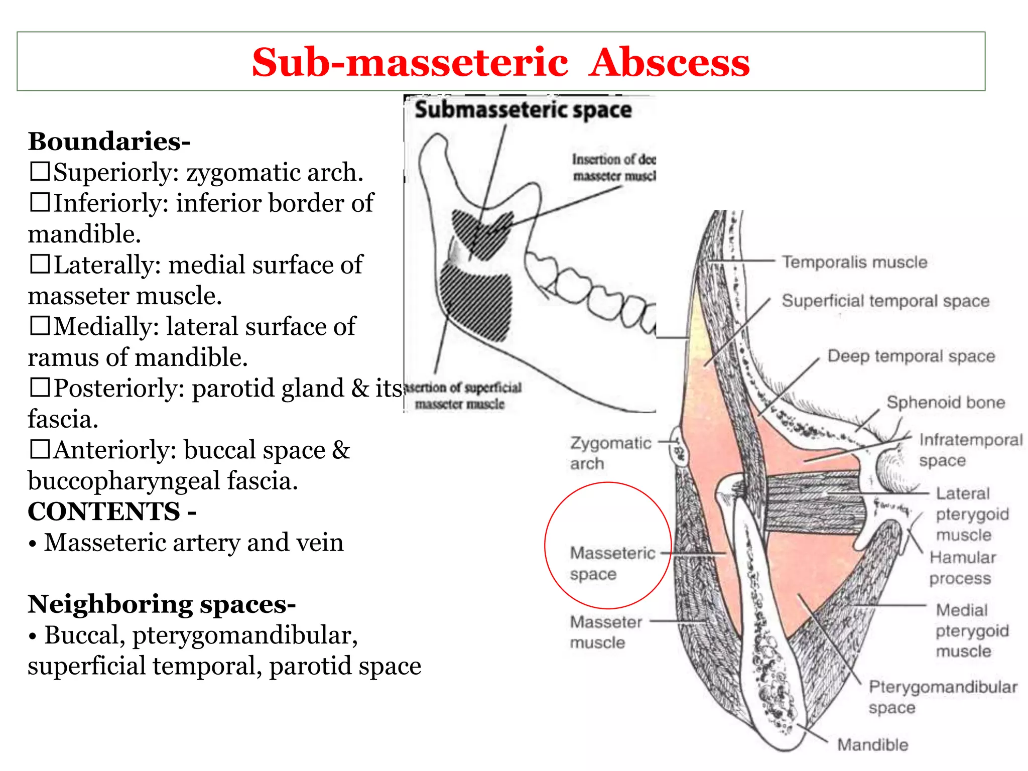 Abscess oral maxillo-presentation | PPTX