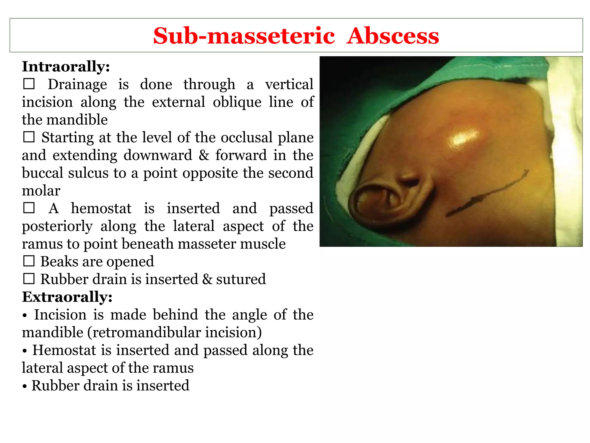 Abscess oral maxillo-presentation | PPTX
