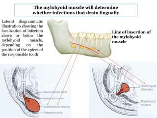 Submandibular Abscess Ppt