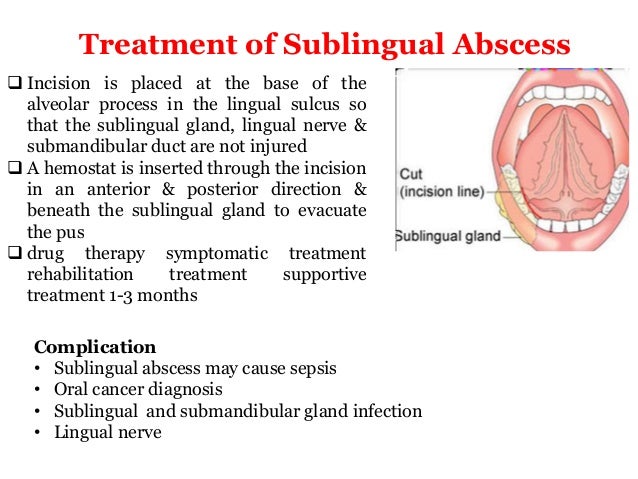 Abscess oral maxillo-presentation