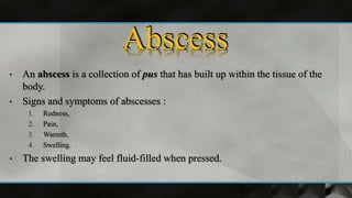 Abscess | PPTX