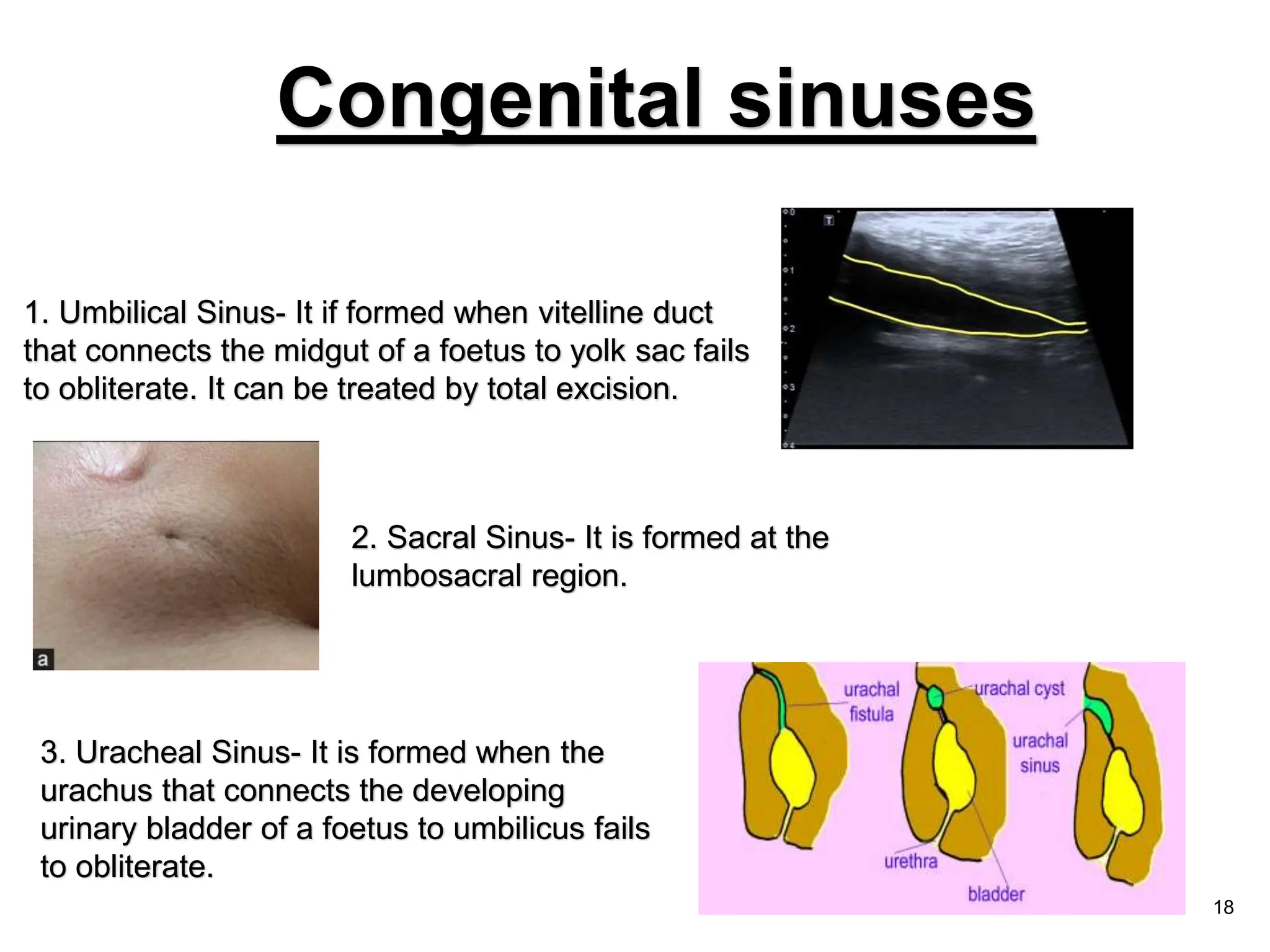 Abscess and its types, treatment . SINUS and its types | PPTX