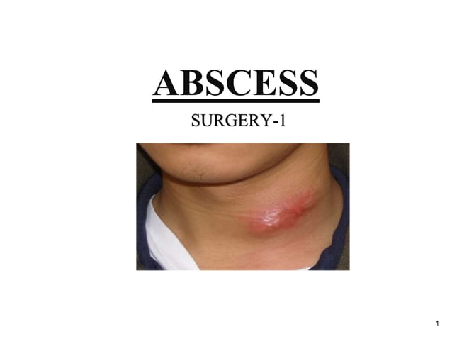 Abscess and its types, treatment . SINUS and its types | PPT