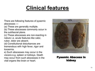 Abscess and its types, treatment . SINUS and its types | PPT