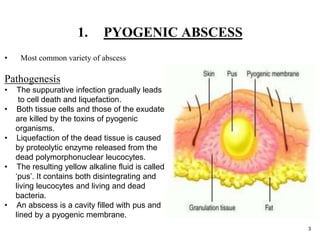 Abscess and its types, treatment . SINUS and its types | PPT