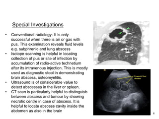 Abscess and its types, treatment . SINUS and its types | PPT