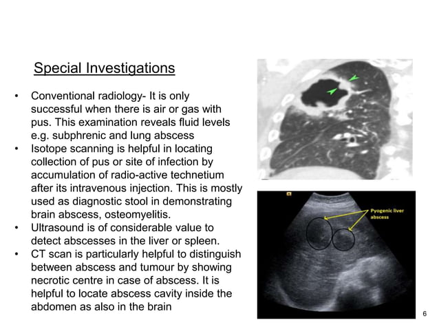 Abscess and its types, treatment . SINUS and its types | PPT