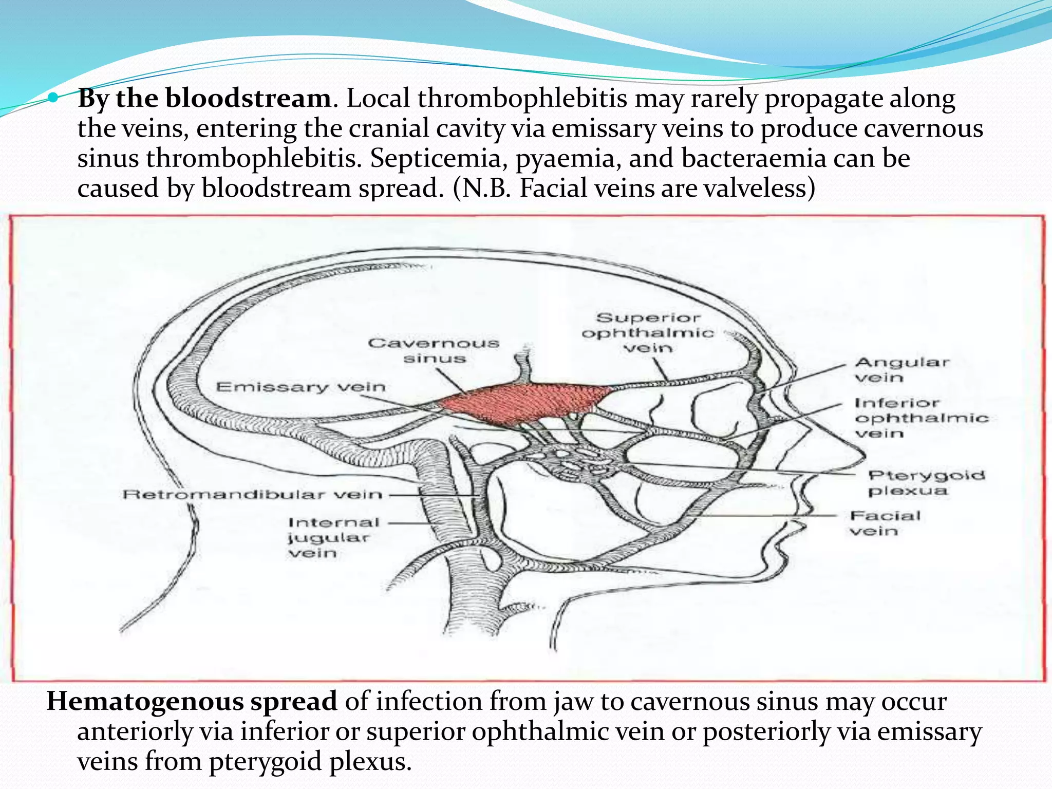 Abscess and phlegmon in maxillofacial region odontogenic infections- | PPSX