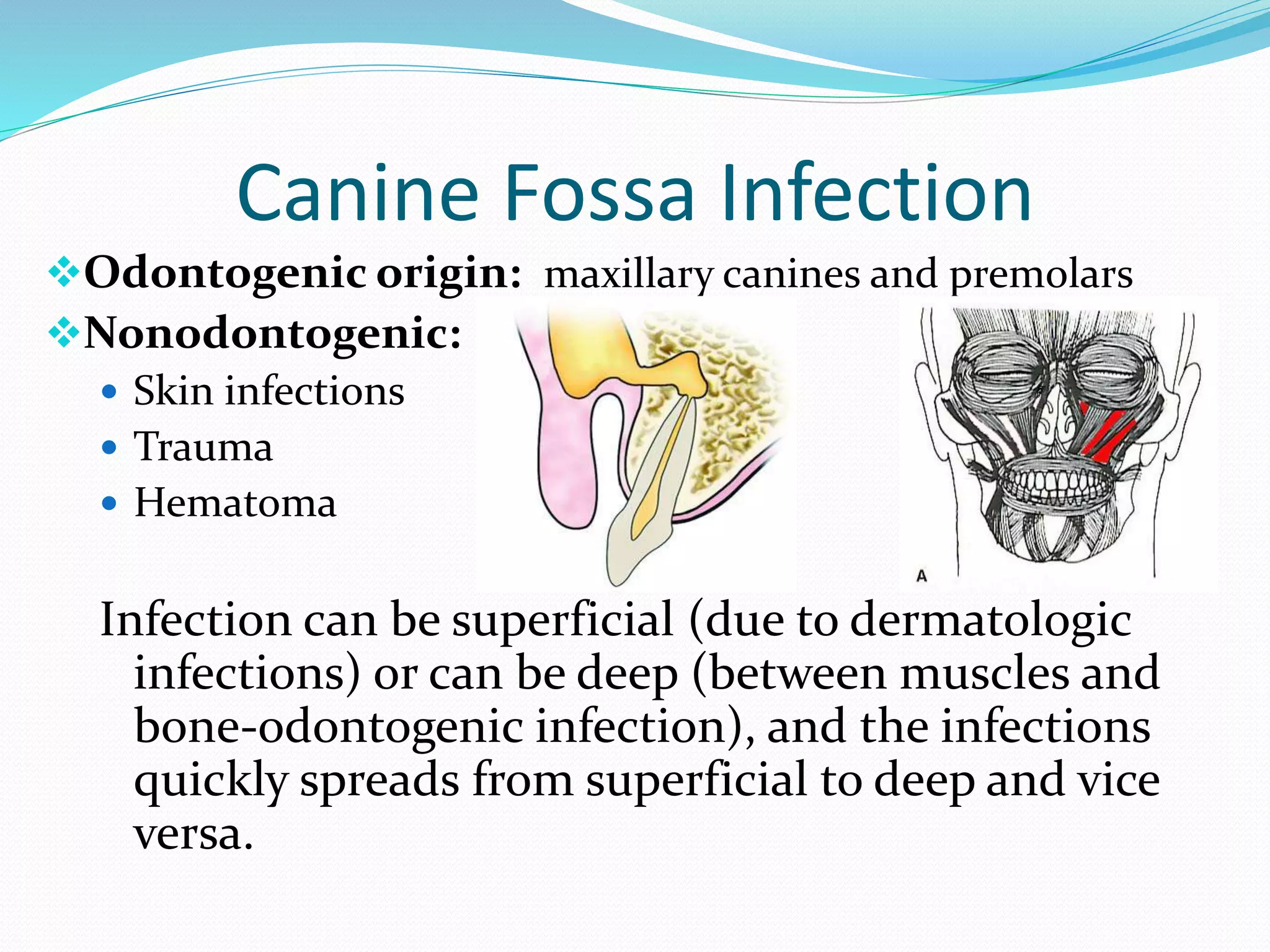 Abscess and phlegmon in maxillofacial region odontogenic infections- | PPSX
