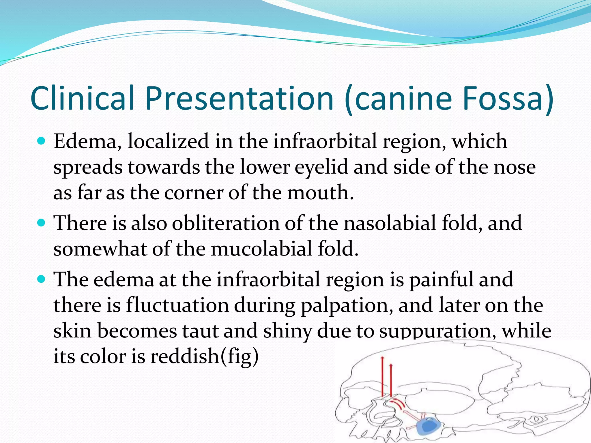 Abscess and phlegmon in maxillofacial region odontogenic infections- | PPSX