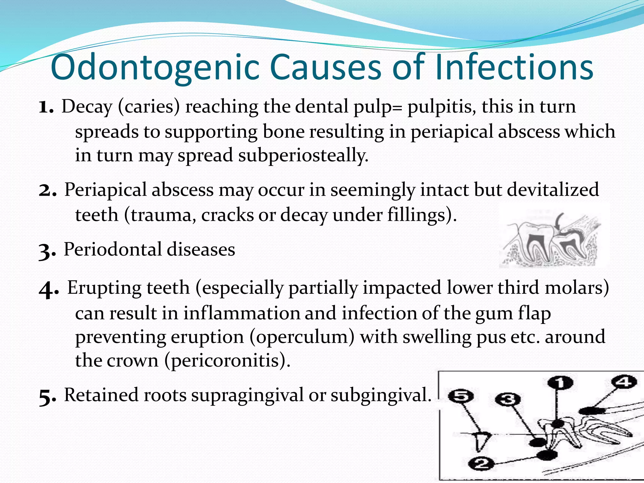 Abscess and phlegmon in maxillofacial region odontogenic infections- | PPSX