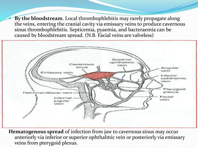 Abscess and phlegmon in maxillofacial region odontogenic infections- | PPSX