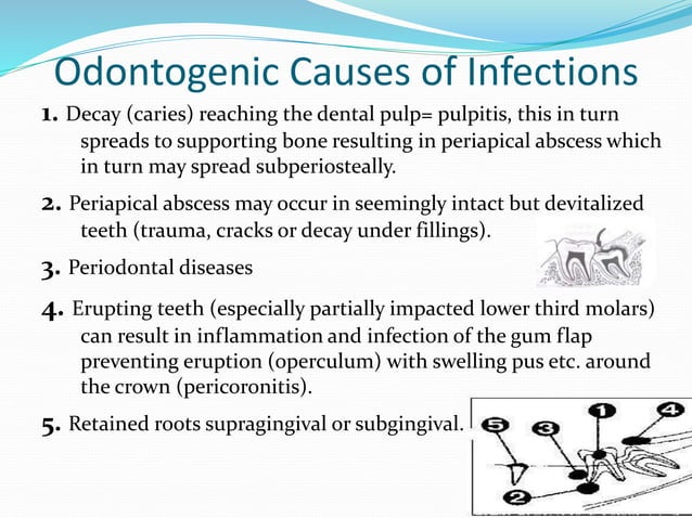 Abscess and phlegmon in maxillofacial region odontogenic infections- | PPSX
