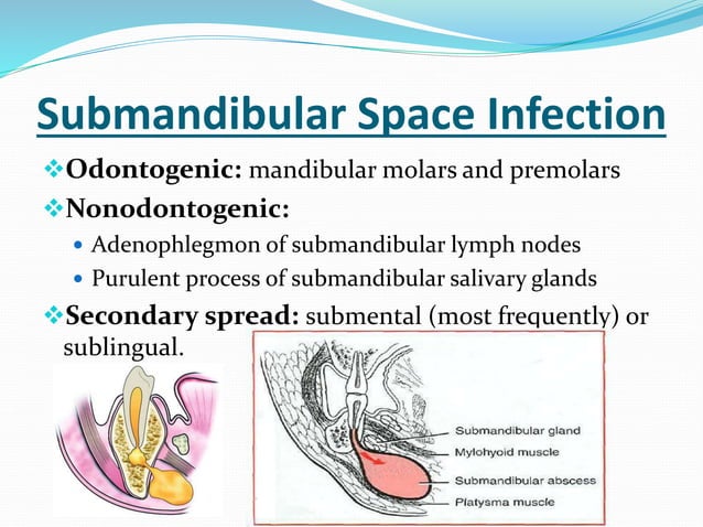 Abscess and phlegmon in maxillofacial region odontogenic infections-