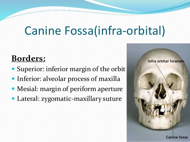 Abscess and phlegmon in maxillofacial region odontogenic infections-