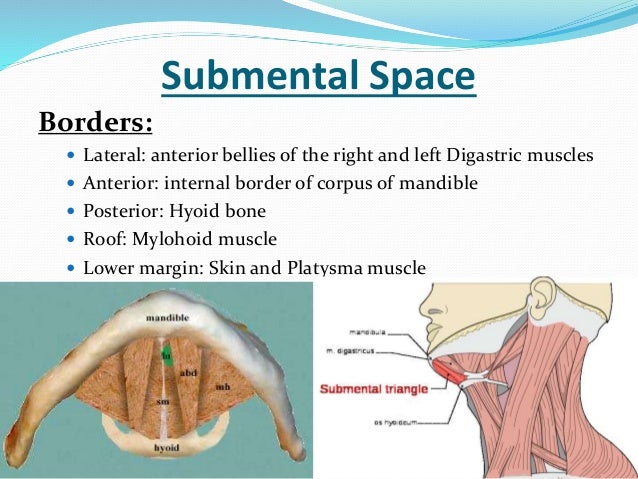Abscess and phlegmon in maxillofacial region odontogenic infections-