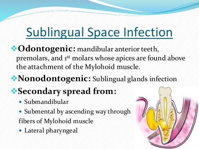 Abscess and phlegmon in maxillofacial region odontogenic infections-