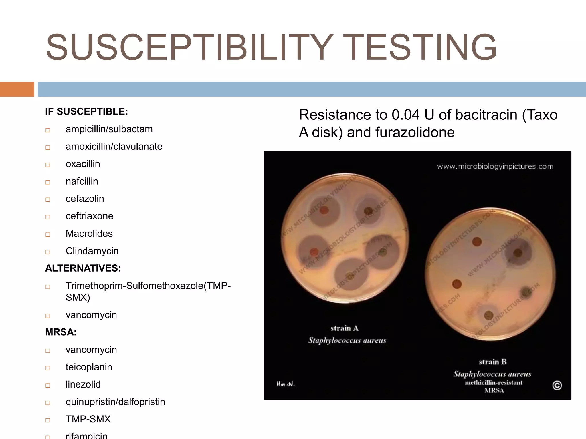 Abscess aspirate specimen analysis final | PPTX