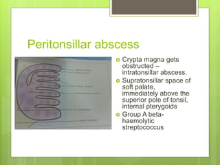 Abscesses of pharynx | PPTX
