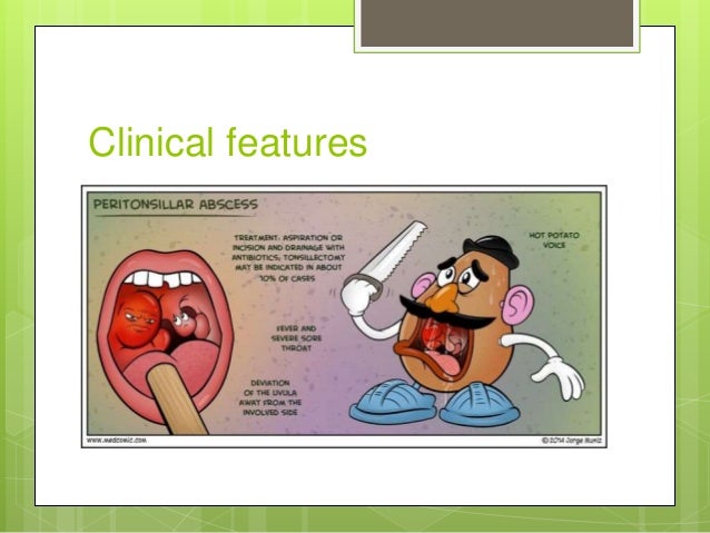 Abscesses Of Pharynx
