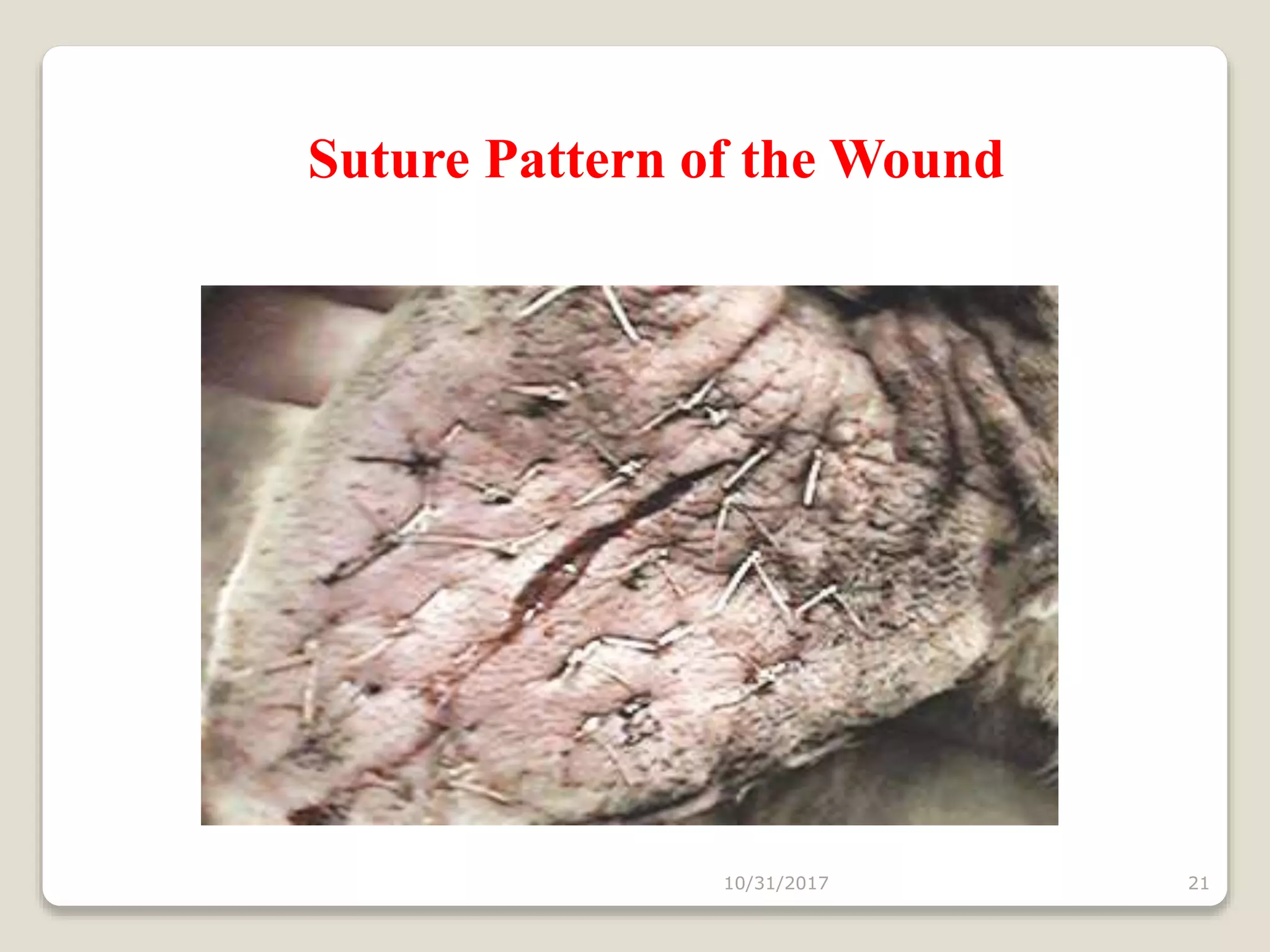 Abscess hematoma & maggot wound | PPTX