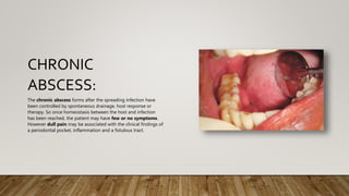 Abscess of periodontium | PPTX