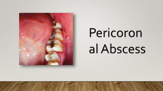 Abscess of periodontium | PPTX