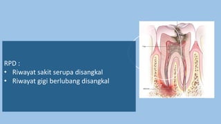 abses submandibula.pptx