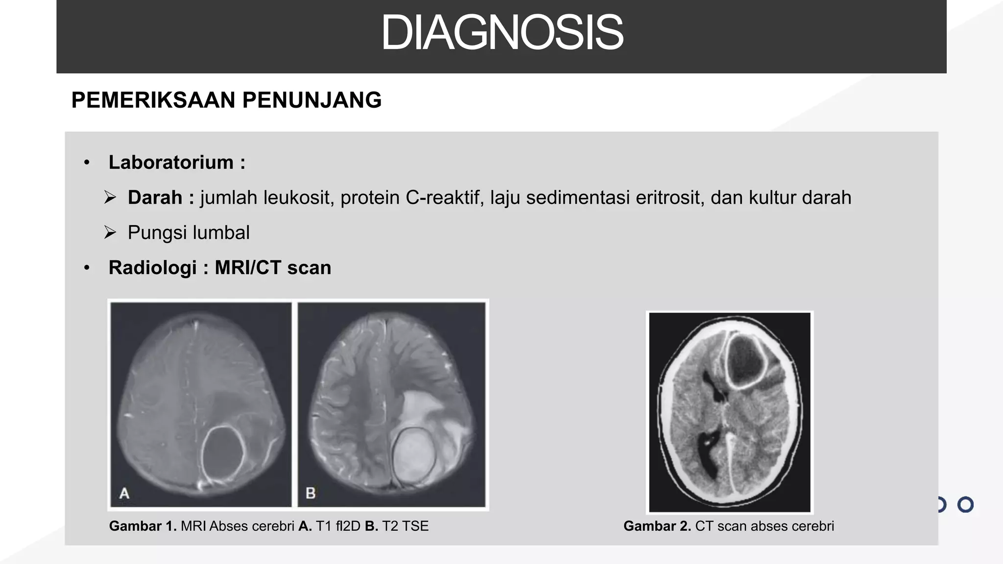 Abses cerebri.pptx