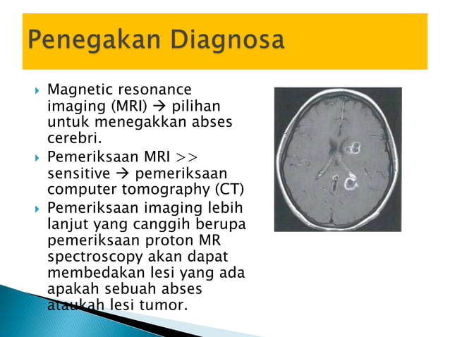 Abses Cerebri pada Pediatrik dan tatalaksananya | PPT
