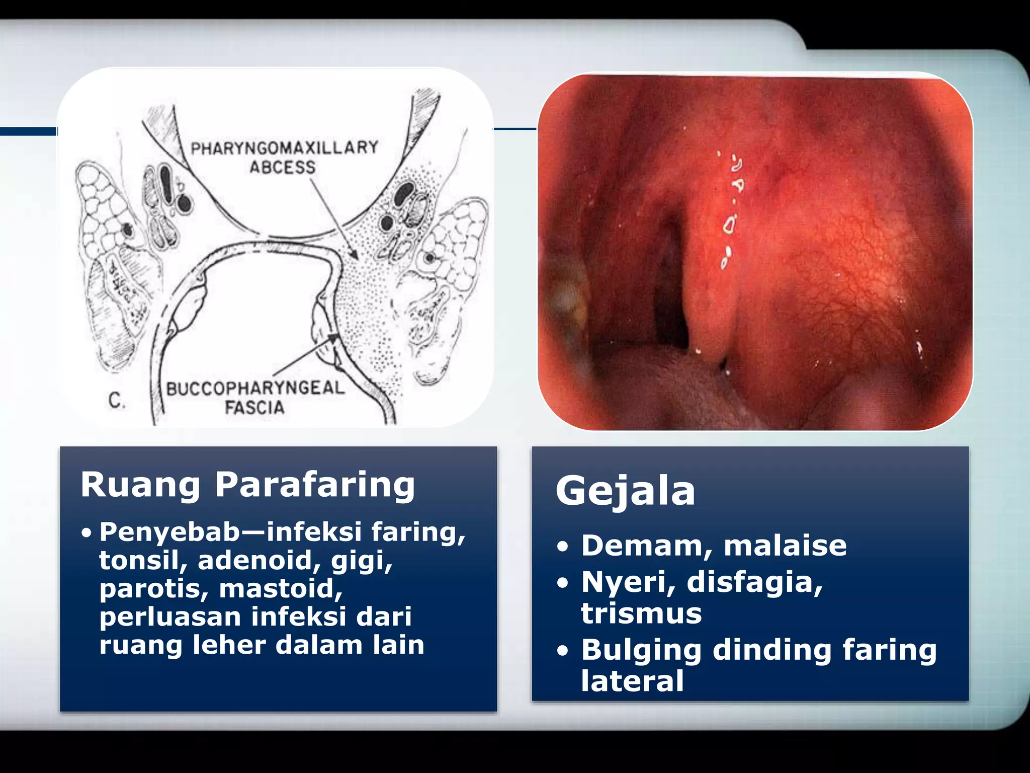 ABSES LEHER DALAM - Bimbingan.pptx