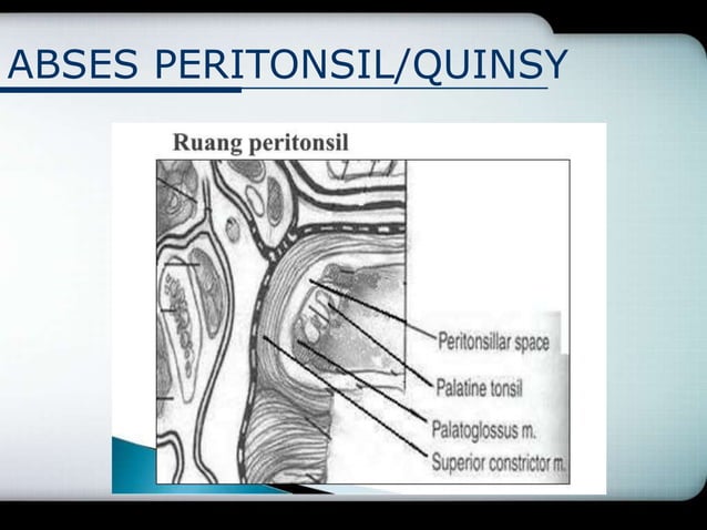 ABSES LEHER DALAM - Bimbingan.pptx