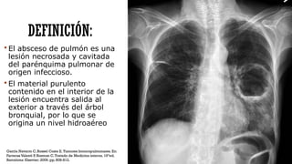 ABSESO PULMONAR abordaje y diagnostico actualidades | PPTX