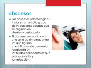 Absesos | PPTX