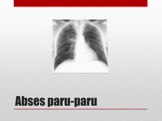 Abses paru-paru, Pleurisi dan Empyema | PPT
