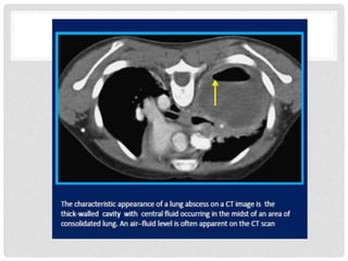 ABSES PARU present.pptx