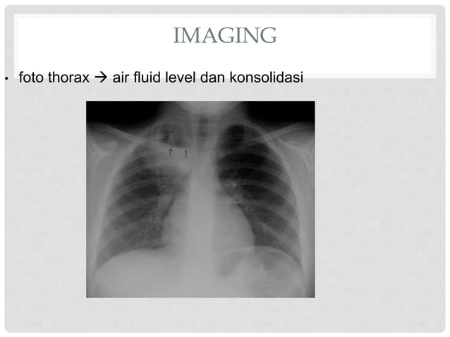 ABSES PARU present.pptx