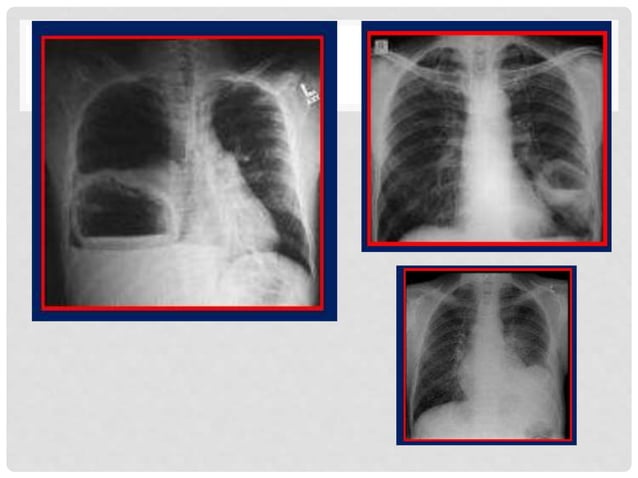 ABSES PARU present.pptx