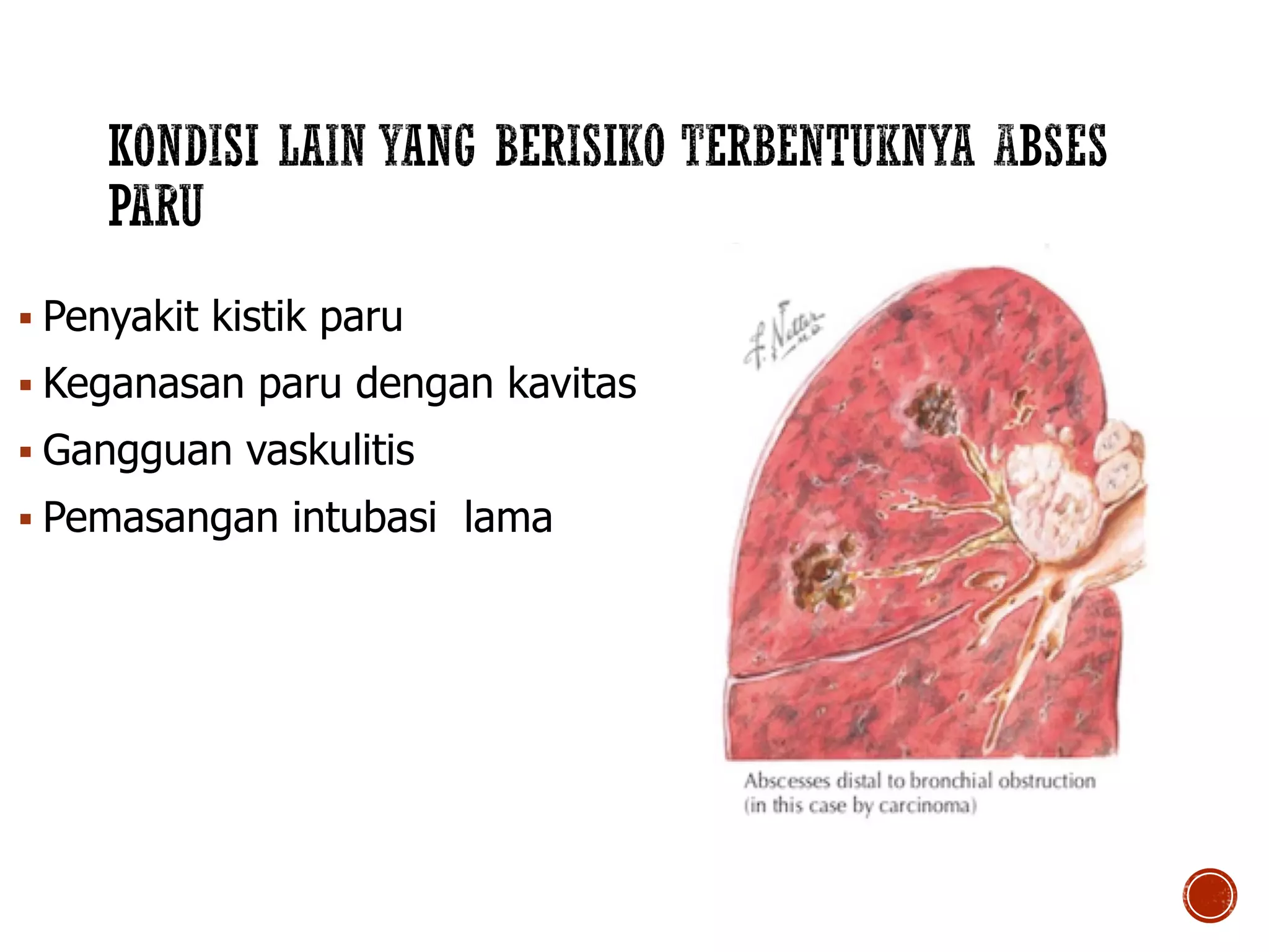 ABSES PARU TUGAS BACA HENDRIS.pdf