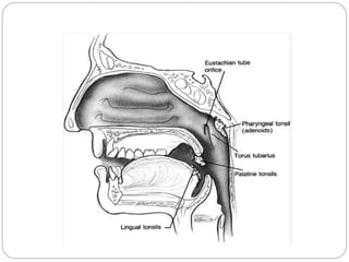 Abses peritonselar | PPTX